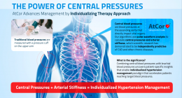 CardieX - What is SphygmoCor?