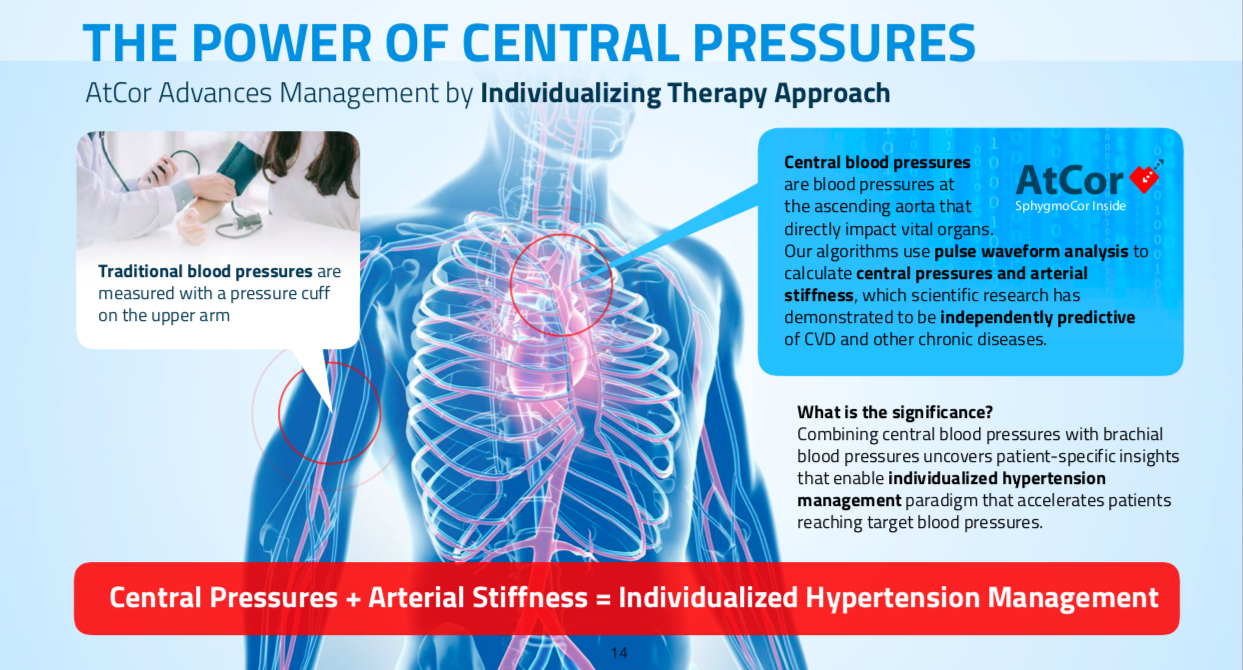 Cardiex - What is SphygmoCor?