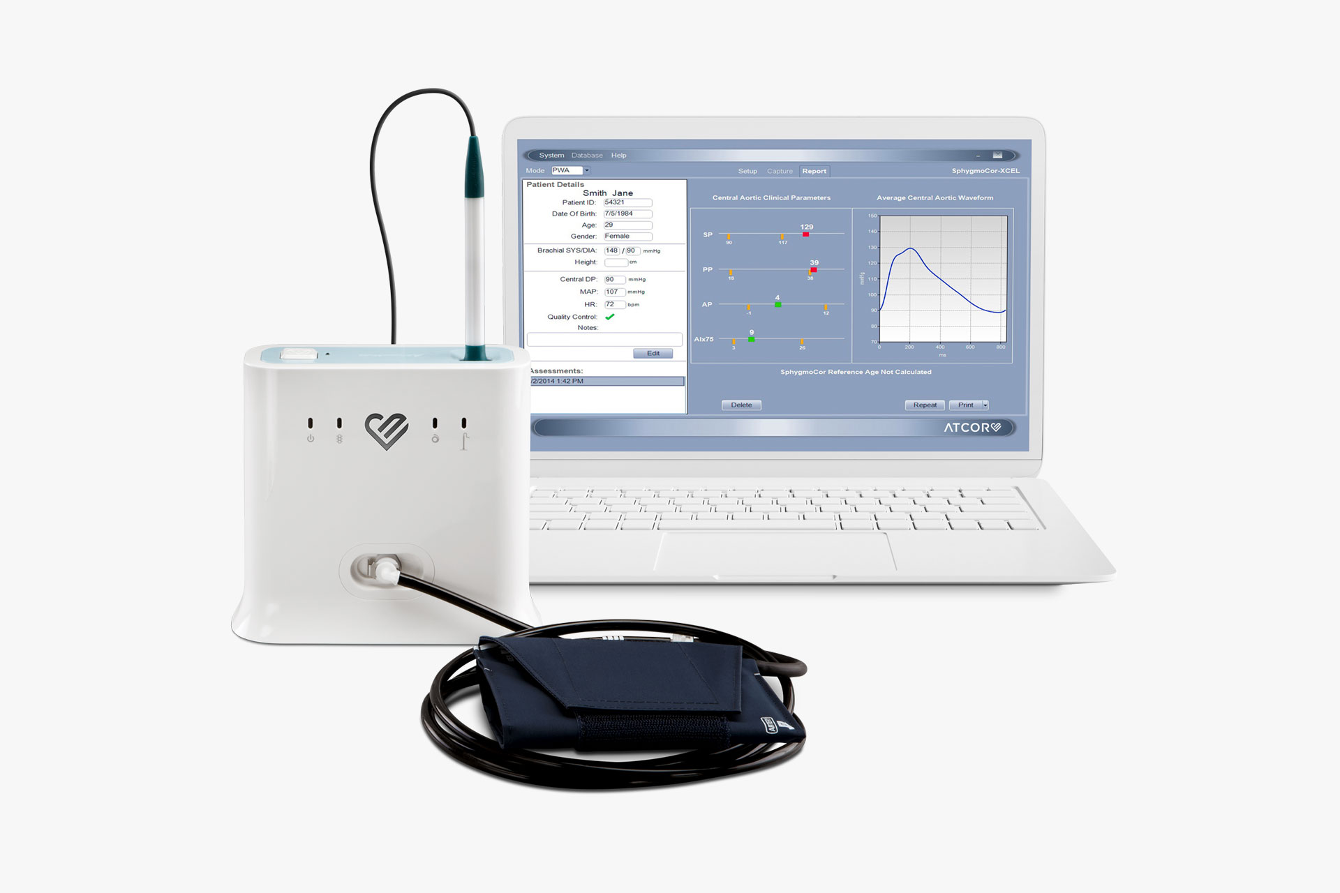 Cardiex - What is SphygmoCor?