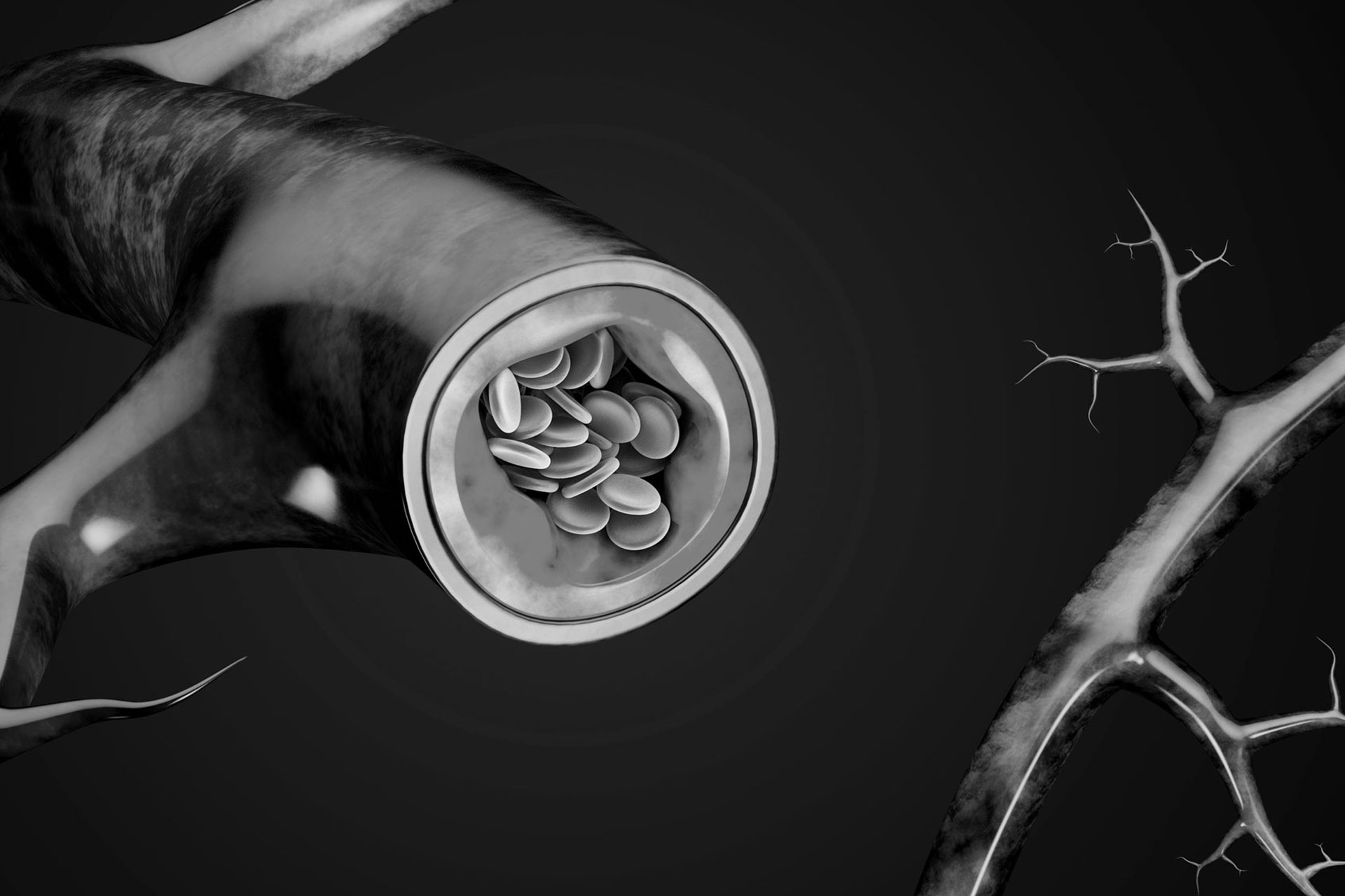 Arterial Stiffness Impacts On Patient Vascular Health | ATCOR