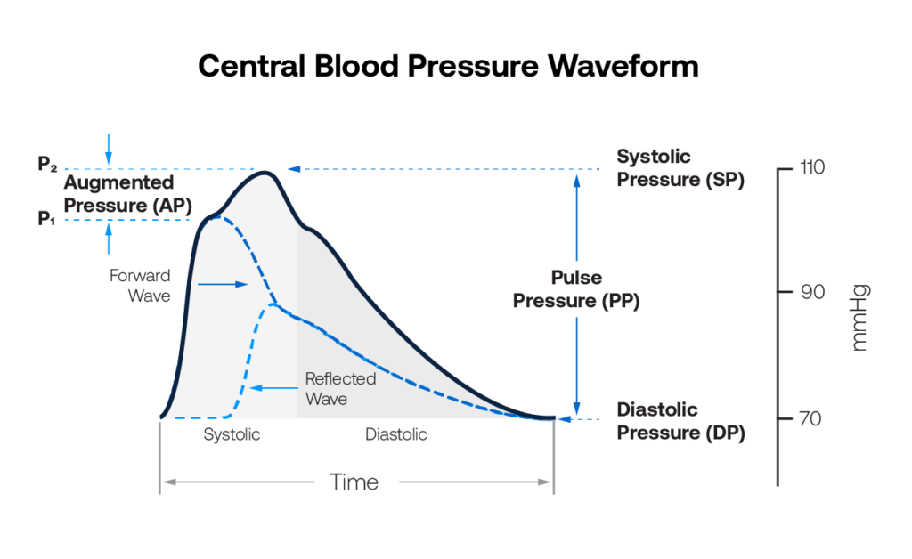 SphygmoCor Technology