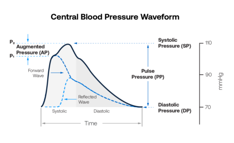 SphygmoCor Technology