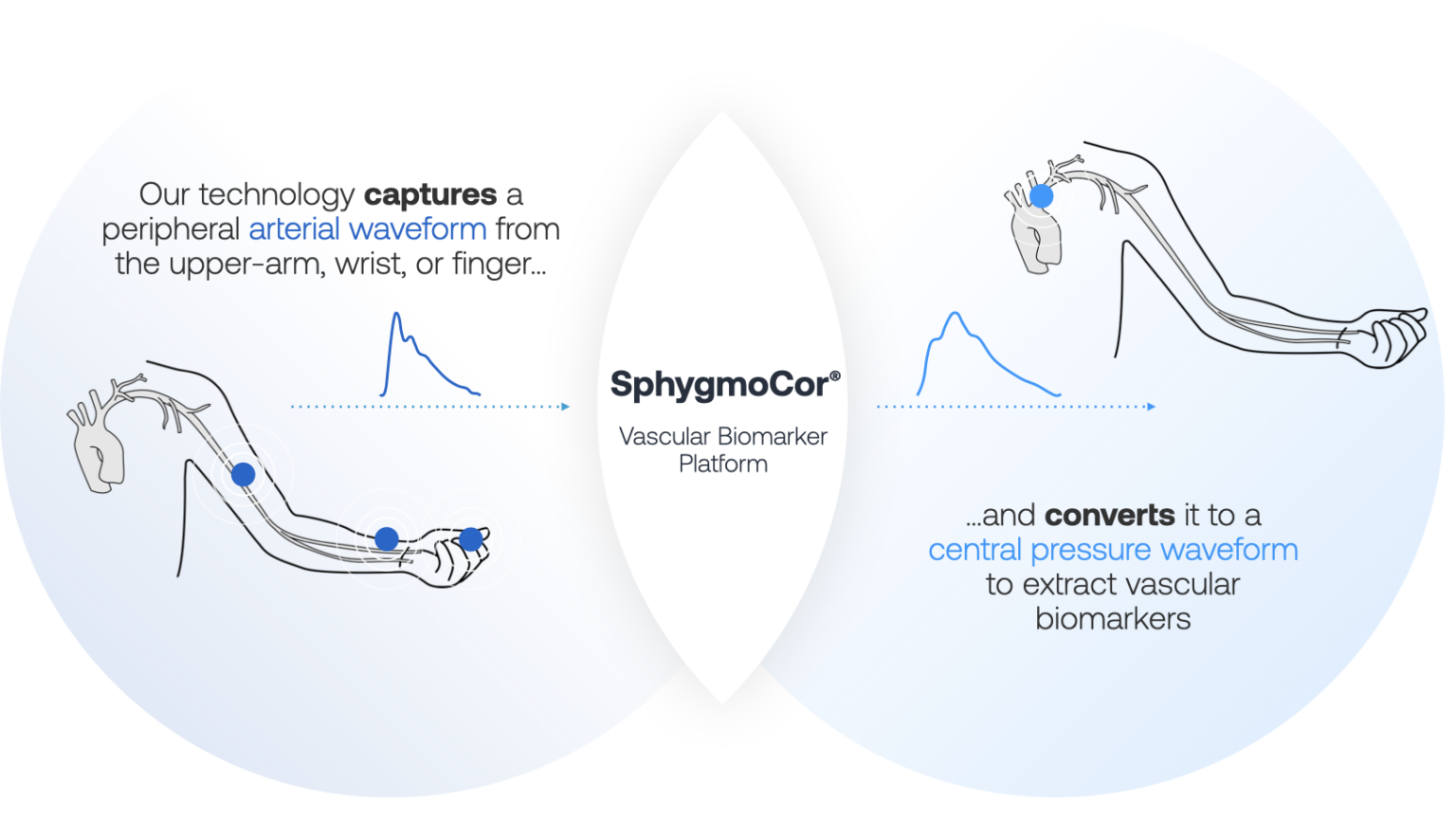 SphygmoCor Technology